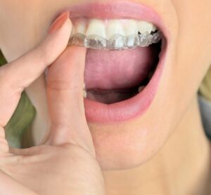 Protect Your Teeth with a Night Guard - Bur Oak Dental